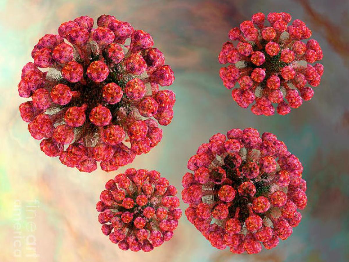 Aumenta en un 26% los casos de rubéola congénita en el país | Radio ...